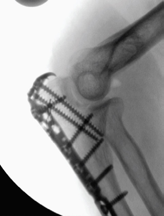 Unfallchirurgie - NEU